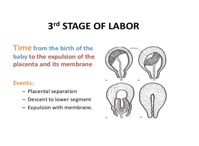Physiology, Mechanism And Principles Of The Third Stage Of Labour ...